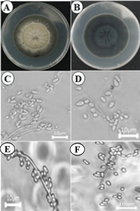 Morphological Characteristics Of Pseudocercosporella Fraxini Knu16 102
