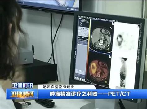 Pet Ct The Paper