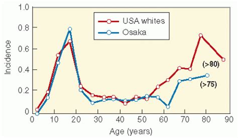 Osteosarcoma Chordoma And Chondrosarcoma Radiology Key