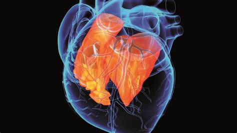Heart Patients To Benefit From Innovative Software In The Uk