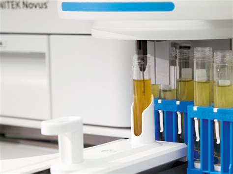 The Clinitek Atlas® Urine Analyzer Is Approaching End Of Life Status