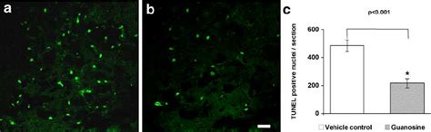 Tunel Positive Apoptotic Cells In Spinal Cord Lesions Were Quantified