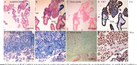 Figure 1 From Role Of Placenta Specific Protein 1 In Trophoblast