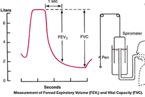 What Is Forced Vital Capacity FVC Vinmec