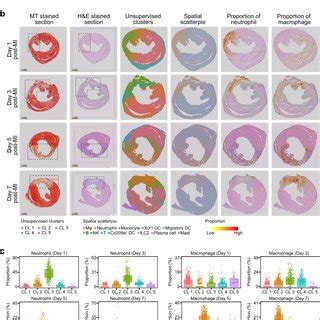 Spatial Transcriptome Sequencing ST Seq Of Mouse Hearts After MI A