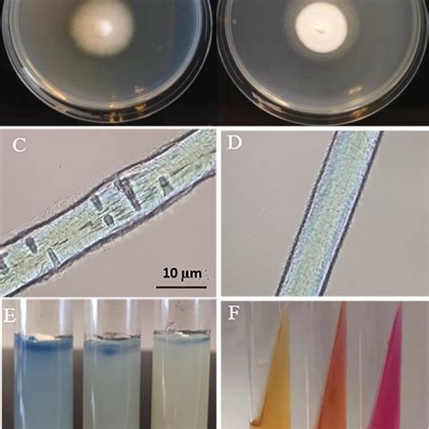 Pdf Taxonomy Of The Trichophyton Mentagrophytest Interdigitale