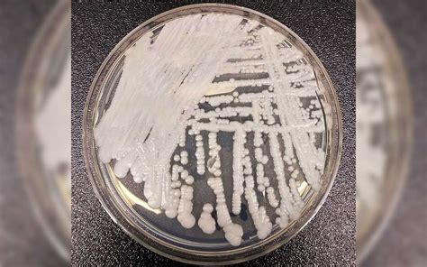 EU Aumentan Infecciones Por Hongo Superresistente Y Potencialmente