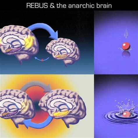 the top row depicts aberrant brain dynamics in which over‐weighted