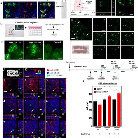 Choroid Plexus Explants Maintain Epithelial Cell Polarization A