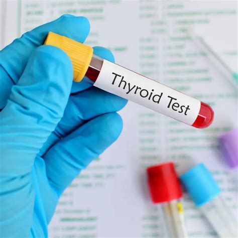 Thyroid Profile Test At Home In Dubai Starting From Aed 149