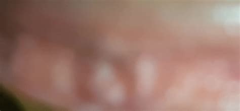 Shrunken 2