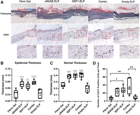 Multifunctional Elastin Like Polypeptide Fusion Protein Coacervates Inhibit Receptor Mediated