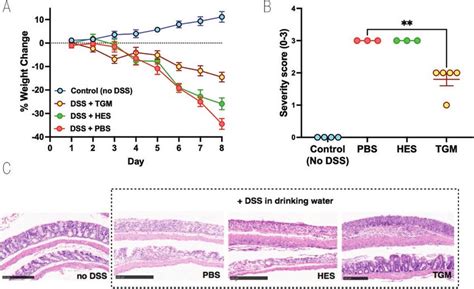 Protection From T Cell Dependent Colitis By The Helminth Derived Immunomodulatory Mimic Of