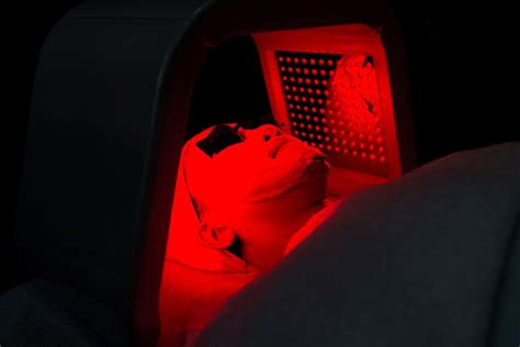 Red Light Therapy For Guttate Psoriasis Shelly Lighting