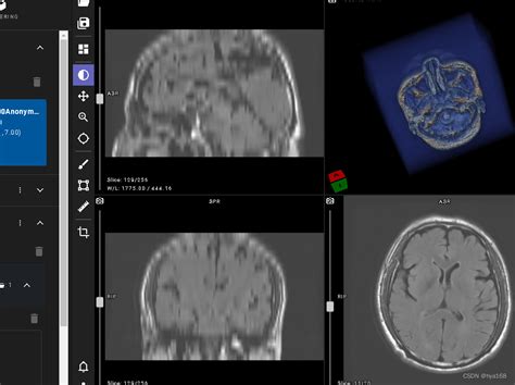 Openeuler（华为欧拉）centos搭建开源pacs系统orthanc Dicom（容器版） Csdn博客