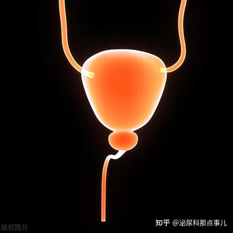 能快速发现膀胱癌的窄谱光技术是什么 知乎