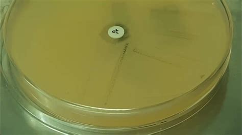 Oxacillin Resistant Staphylococcus Aureus Youtube