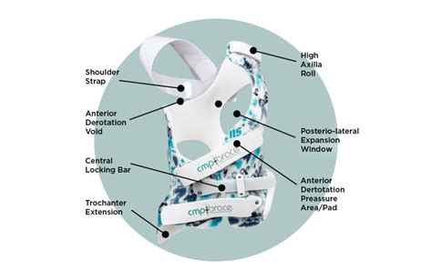 Cmp Brace The In Brace Curve Reduction Brace