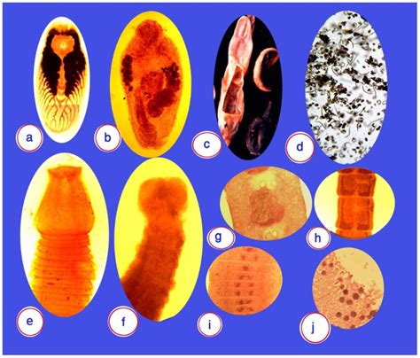 A Metacercaria Of Euclinostromum Heterostomum B Gastrostome A Download Scientific Diagram