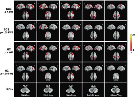 Resting State Cerebellar Cerebral Functional Connectivity In Scz And Hc