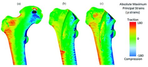 A Comparison Of The Absolute Maximum Principal Strain Distribution Download Scientific