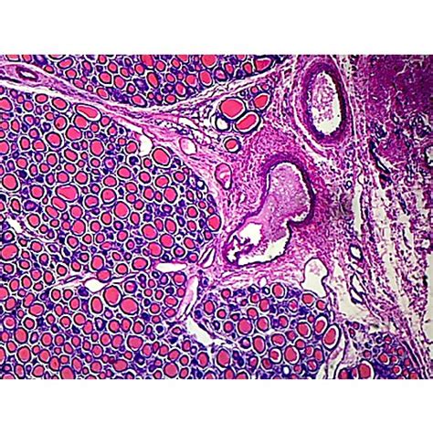 Prepared Microscope Slide Endocrine System Thyroid Gland Section