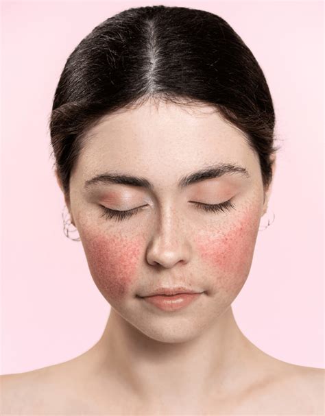 Baumes Lèvres Et Sticks Lèvres Hydratants Alvadiem