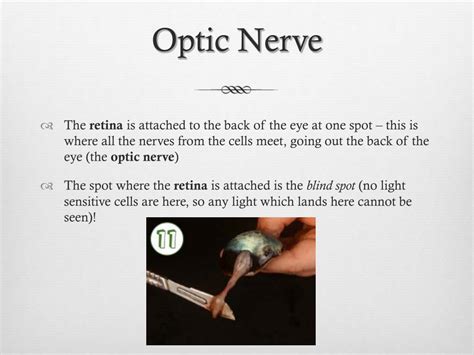 Ppt Eye Dissection Powerpoint Presentation Free Download Id 3643393