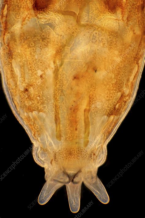 Blackfly Larva Suction Disc Light Micrograph Stock Image C0559578
