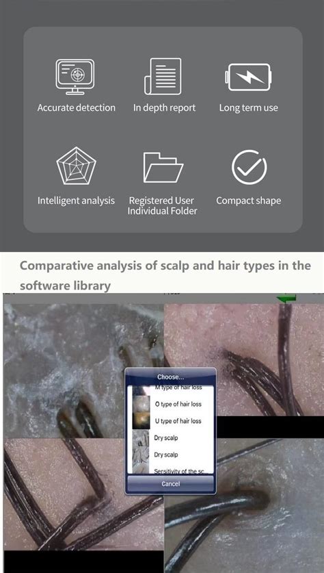 The Transformative Power Of Maikong Beauty Face Analyzer Maikong