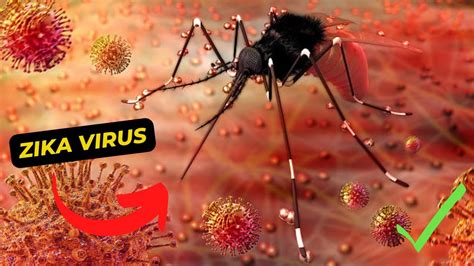 A Comprehensive Guide To The Zika Virus Causes Symptoms Prevention