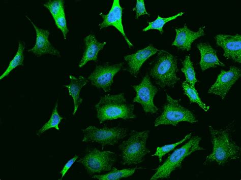 Sino Biological Ngfr Antibody Rabbit Mab 100µl Quantity Each Of 1