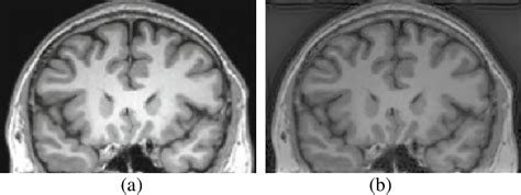 Figure 1 From A Localized Hybrid Penalization Method For Simultaneous Data Reconstruction And