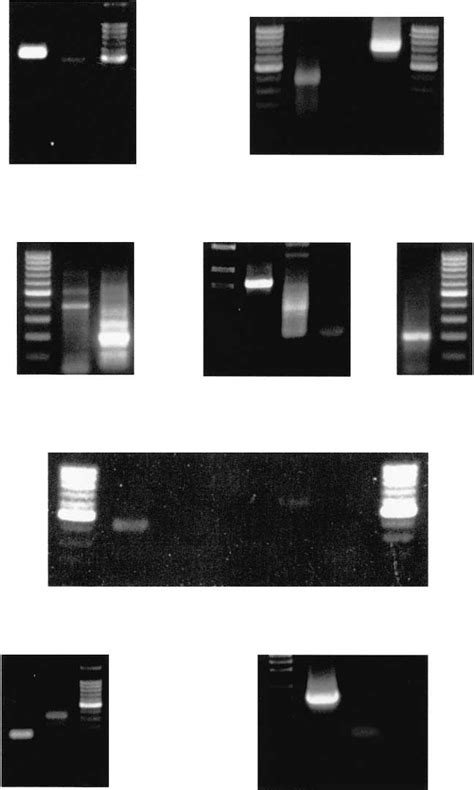 Expression Of Receptor Subtypes For Endothelin 5 Ht And Histamine In Download Scientific