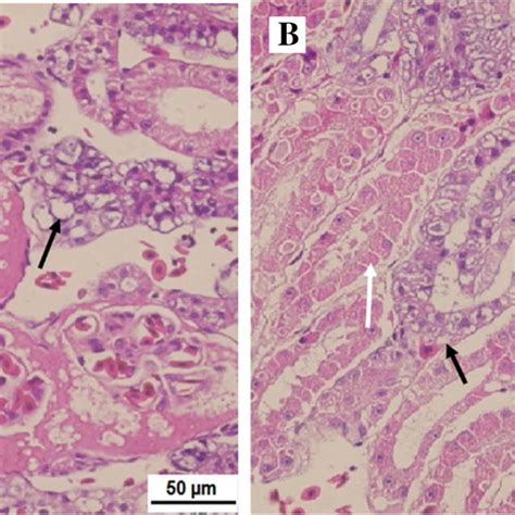 Micrographs Of Histological Sections Of The Testis Stained With