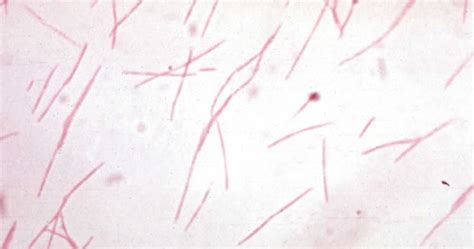 Variety Of Life Fusobacteria