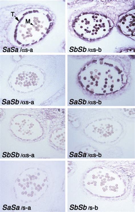 In Situ Localization Of Scra And Scrb Transcripts Paraffinembedded