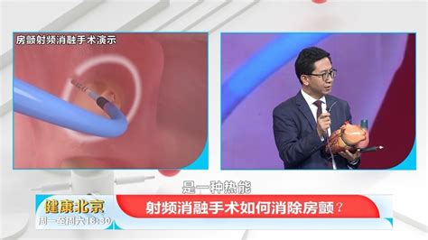 射频消融手术如何消除房颤？北京时间