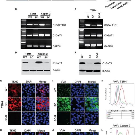 Stn Antigen Enhances Pdac Tumorigenicity A Ihc Analysis Of Stn