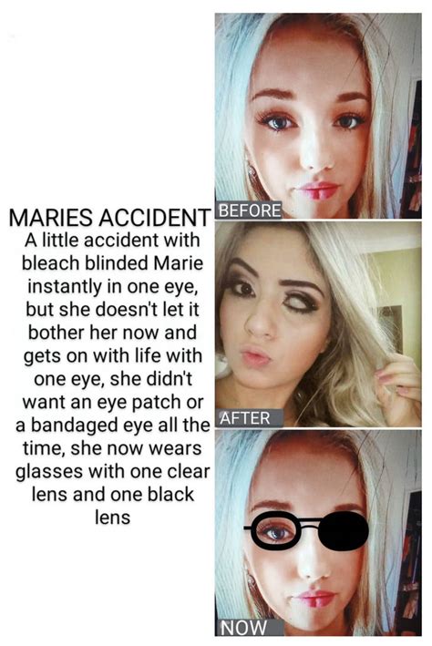 Maries Accident By Treborcos13 On Deviantart