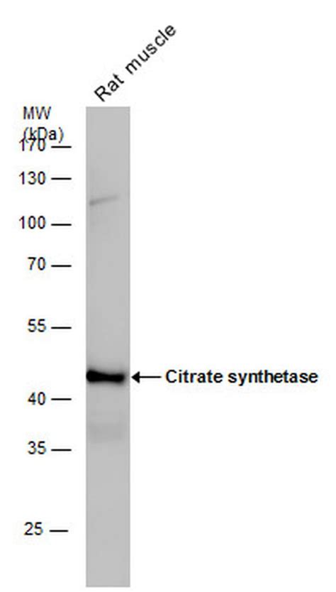 Citrate Synthase Polyclonal Antibody Pa5 22126