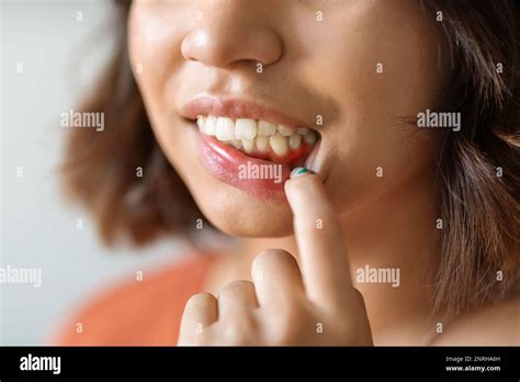 Gingivitis Concept Young Woman Pulling Her Lip And Demonstrating