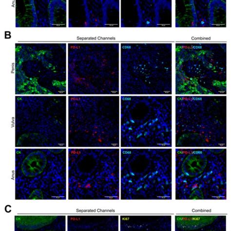 Multiplexed Biomarker Staining Patterns Whole Tissue Sections Were