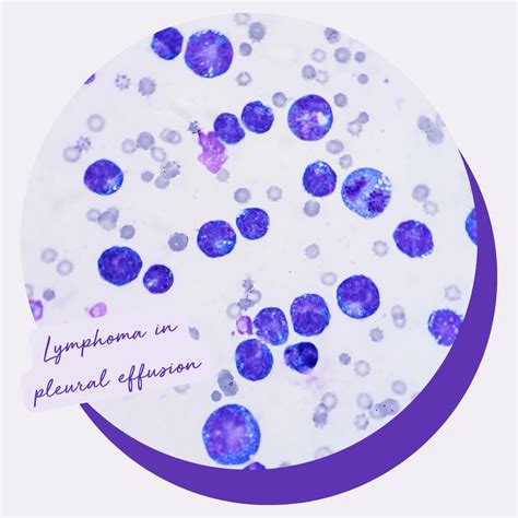 Case Spotlight Pleural Effusion In A Cat