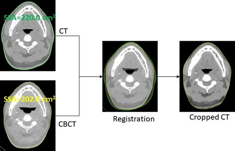 Schematic Diagram Of CT Image Clipping Download Scientific Diagram