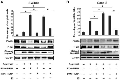 Paxillin Is Positively Correlated With The Clinicopathological Factors Of Colorectal Cancer And