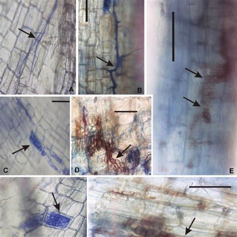 Dark Septate Endophytes And Other Endophytic Fungi Colonization In
