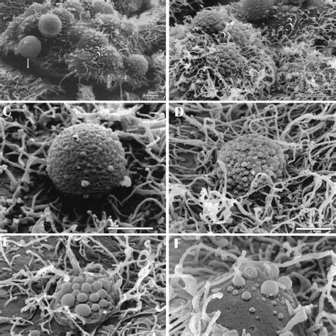 Pdf The Fibronectin Binding Protein Of Streptococcus Pyogenes Sfbi