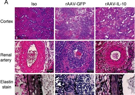 Histologic Evaluation Of Renal Grafts Double Staining Of Periodic