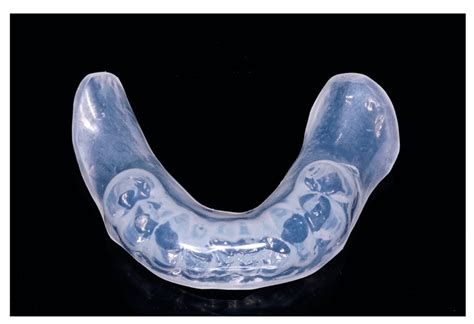 Example Of A Dental Splint That Patients In The Active Control Group